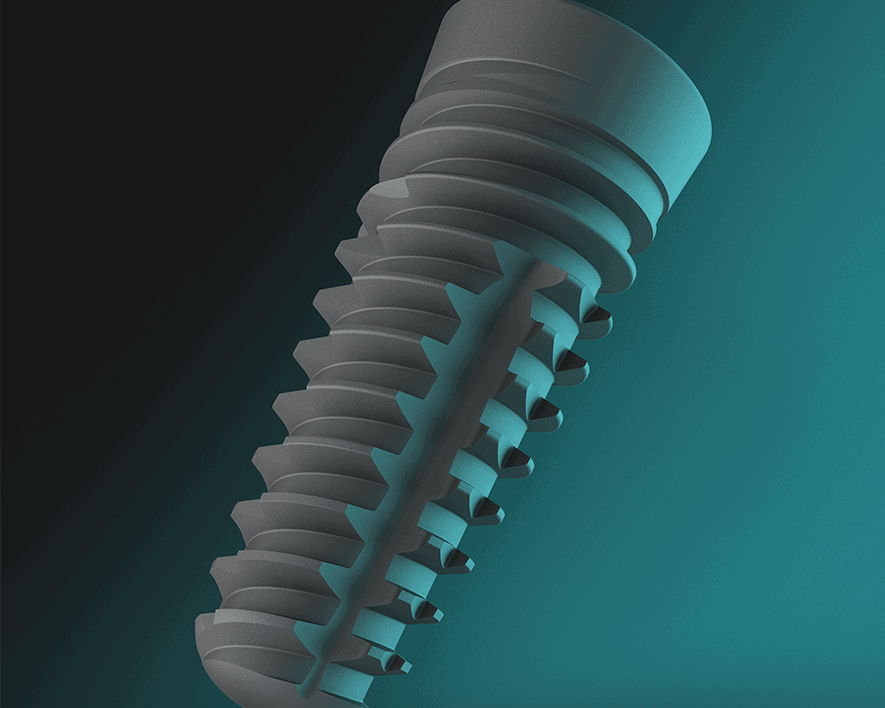 New Neoss ProActive Edge Implants - Now Available in Townsville